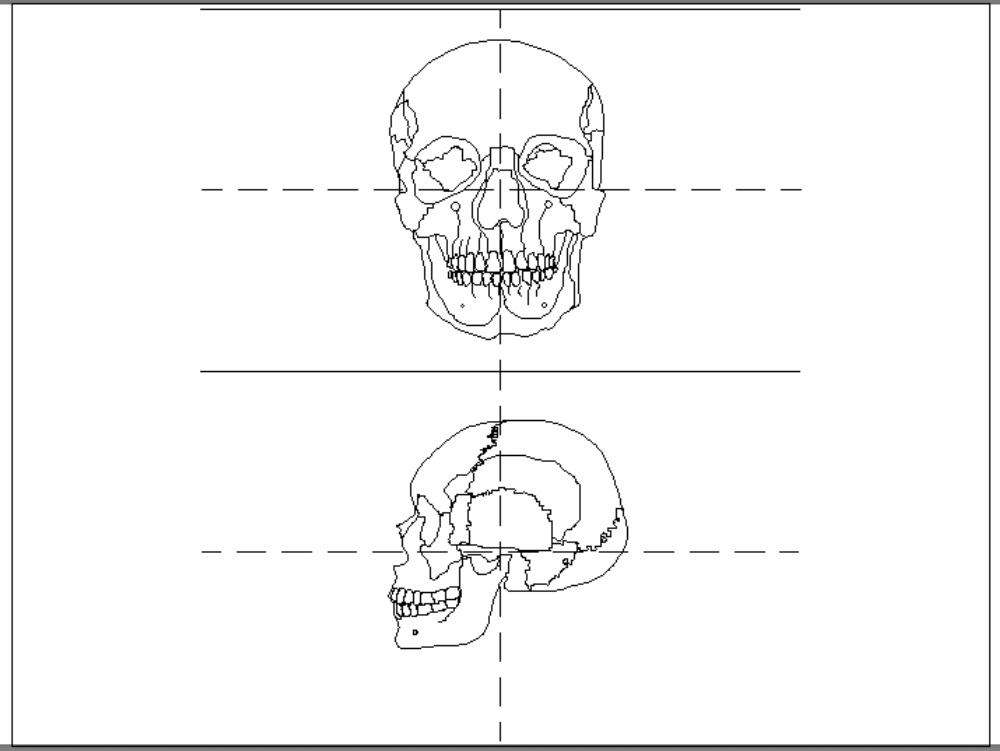 Human skull in AutoCAD | Download CAD free (97.8 KB) | Bibliocad